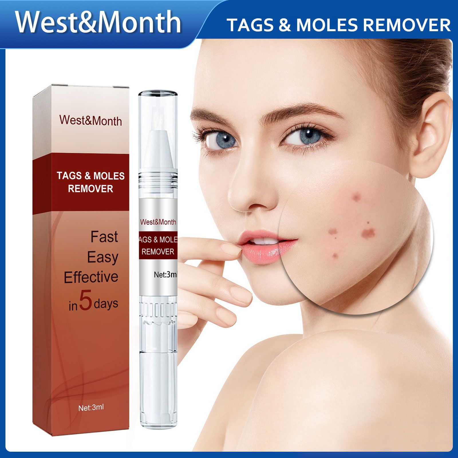 West&month Flat Warts Removal Tags Moles Remover Pen